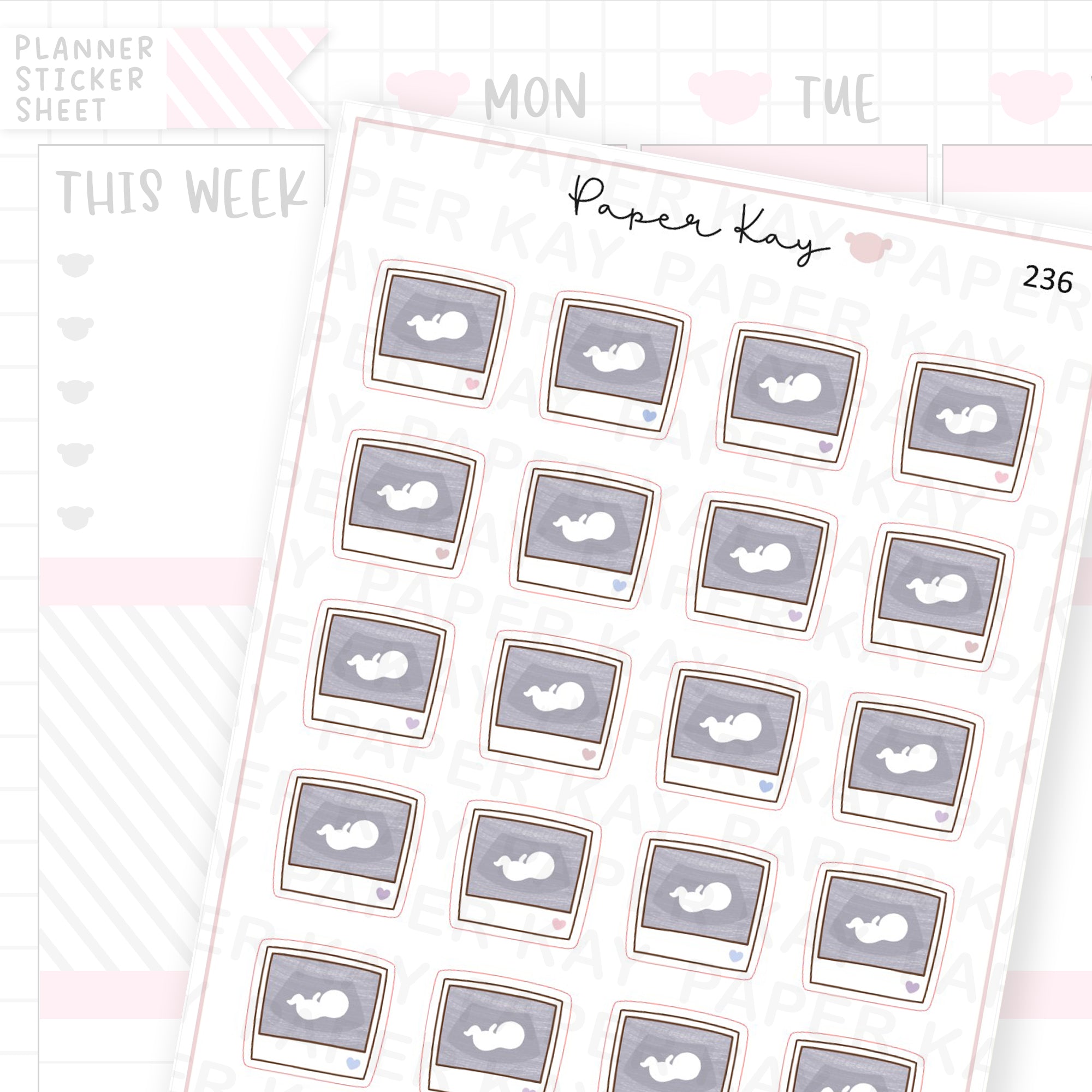 Sonogram/Ultrasound Picture Sticker Sheet – Paper Kay